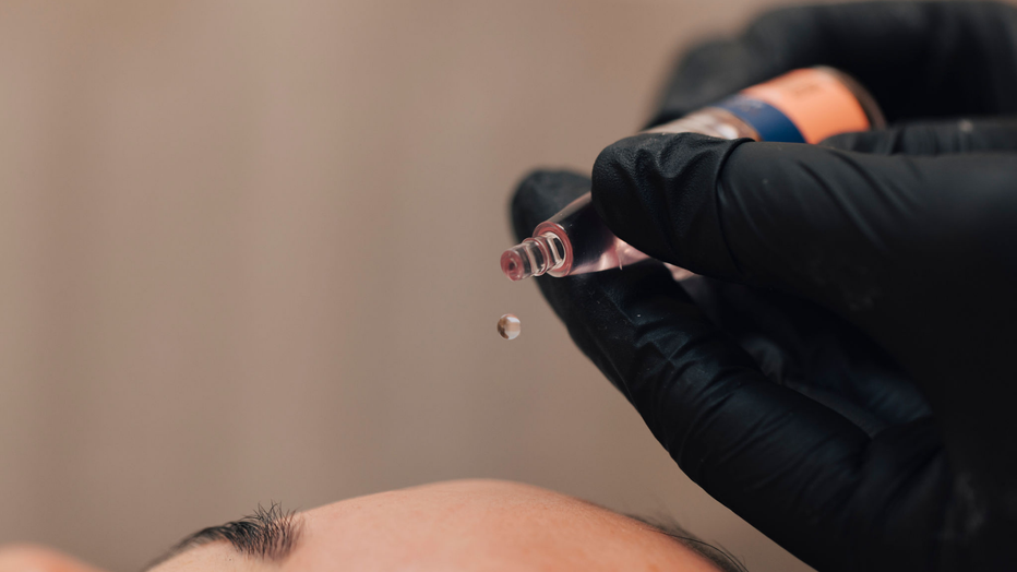 Skin Needling with Exosomes – Pelle.